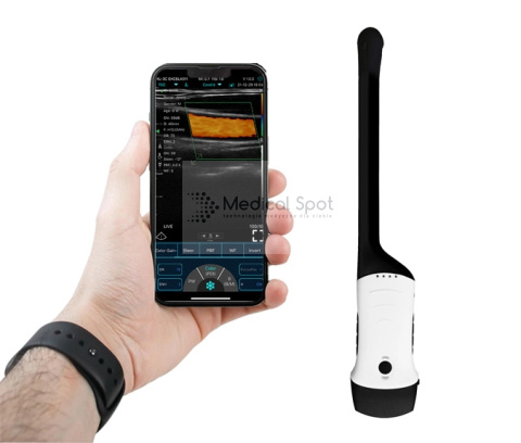 USG przenośne - ultrasonograf przenośny, niska cena